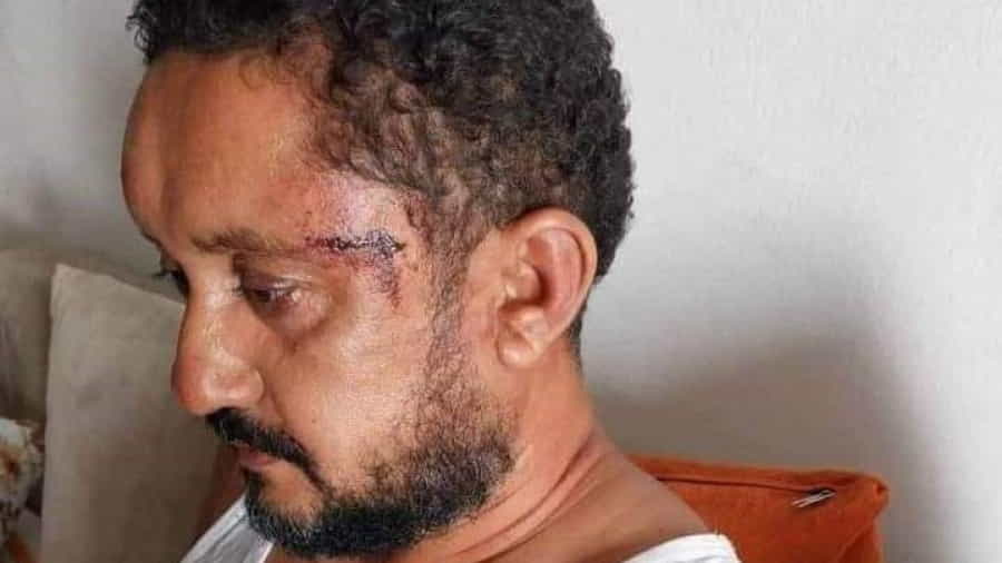 باب نت نقابة الصحفيين تدين الإعتداء الهمجي على صحفي داخل مركز أمن تونس